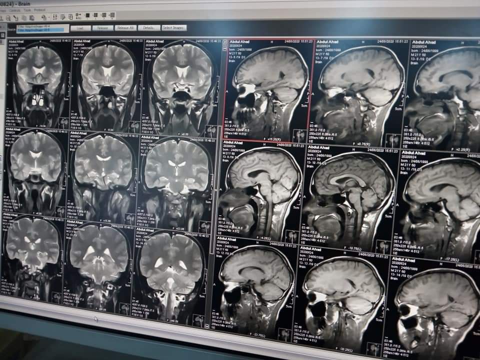 Researchers succeed in recording clearer scans to see the brain - Shia ...