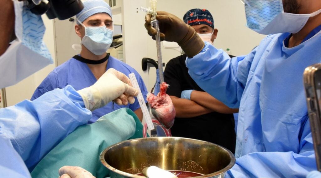United States: Second human receives genetically modified pig heart ...
