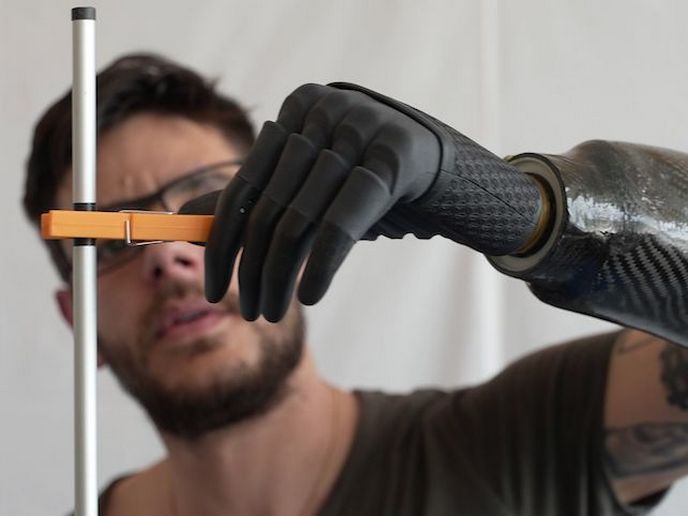Revolutionary Magnetic Prosthetic Hand Transforms Lives of Amputees ...